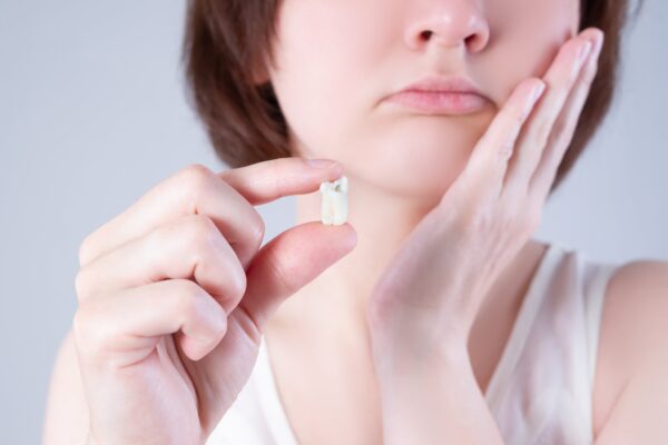 The Importance of Managing Bleeding After Wisdom Tooth Extraction